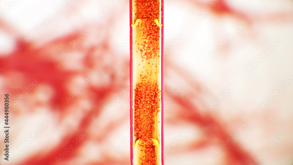 Leg vein anatomy, venous valve function, blood flow, erythrocytes ...