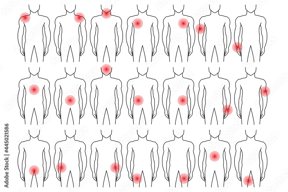 Body Parts Pain Set with Shoulders, Chest, Joints, Genital, Muscles ...