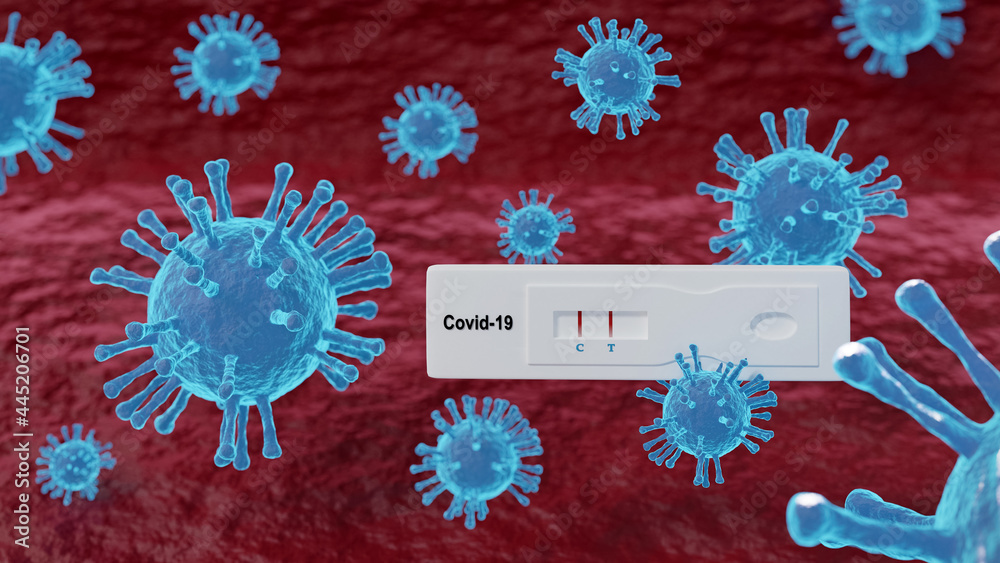 Positive test result by using rapid test device for COVID-19 with virus ...