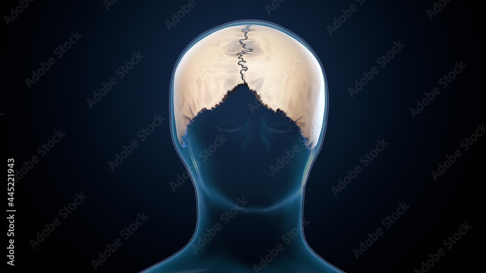 3d illustration of skull parietal bone anatomy . Stock Illustration ...
