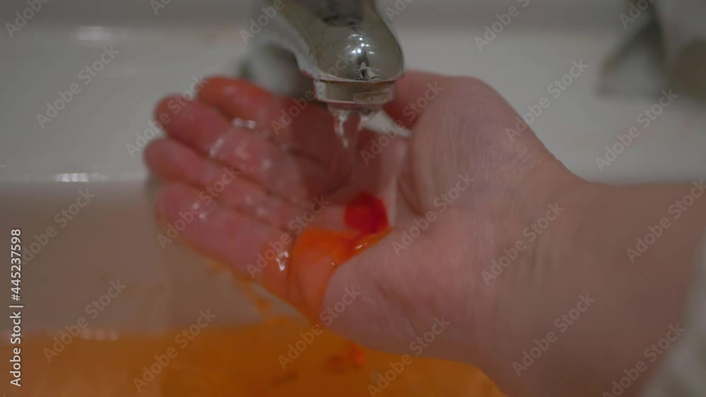 Cleaning bleeding hand after accident in sink Stock Video | Adobe Stock