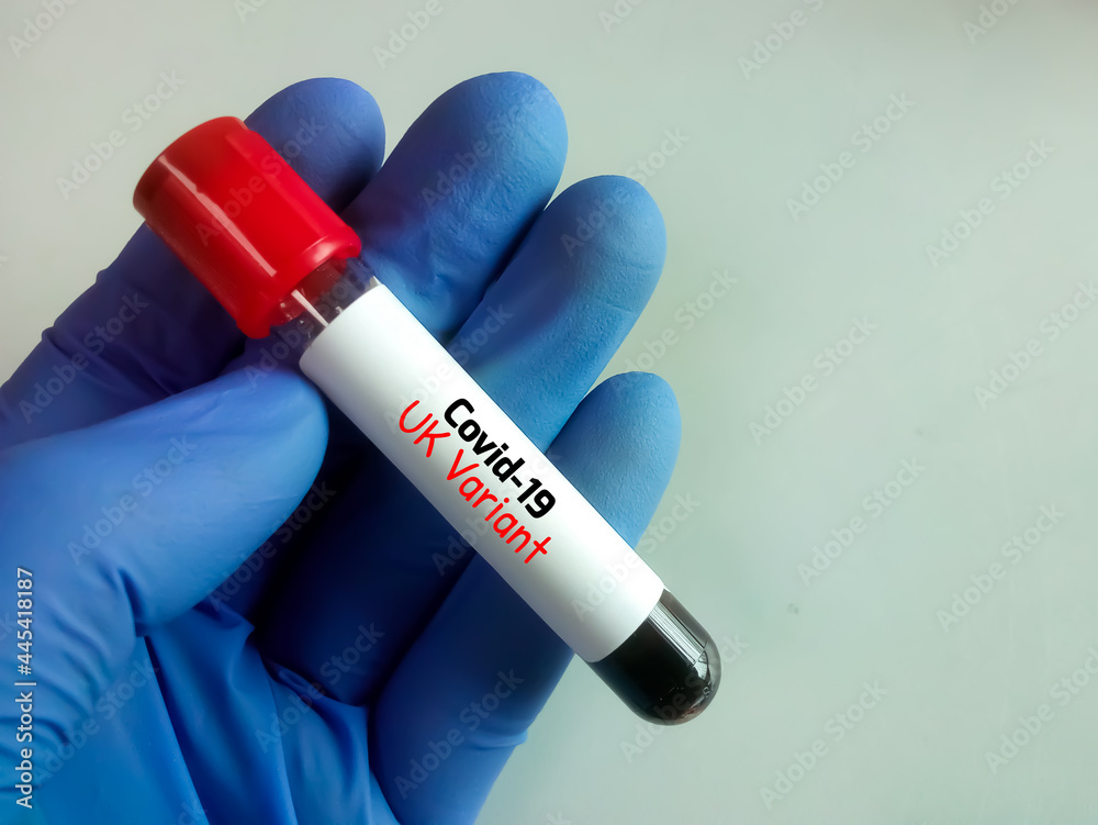 Laboratory Technician with a blood sample with a new variant of the ...