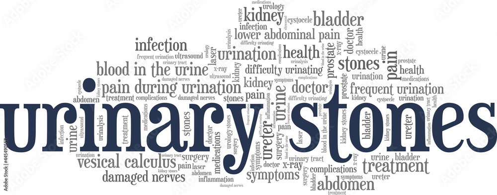 Urinary Stones vector illustration word cloud isolated on a white ...