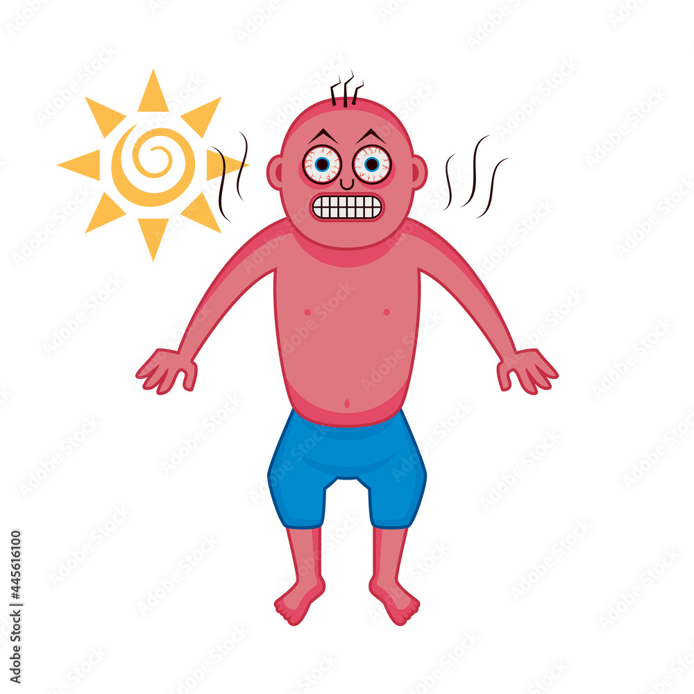 Sunburn Animation