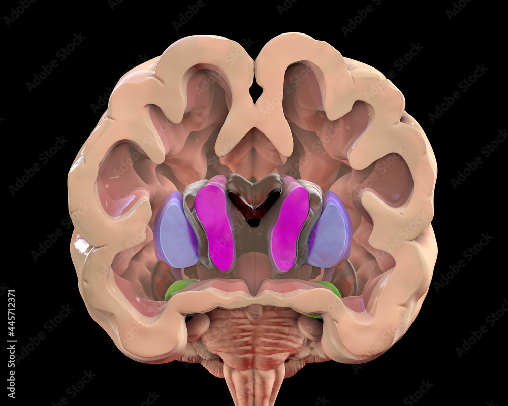 Coronal section of a healthy brain showing normal anatomy of basal ...