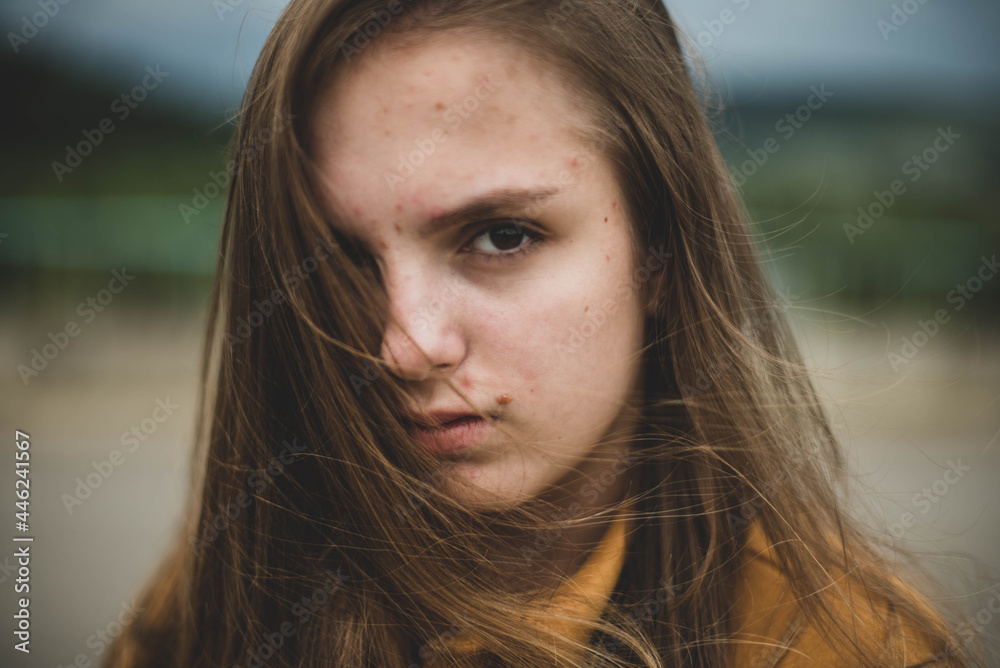 Portrait of young beautiful cute teenage girl woman with frackles and ...