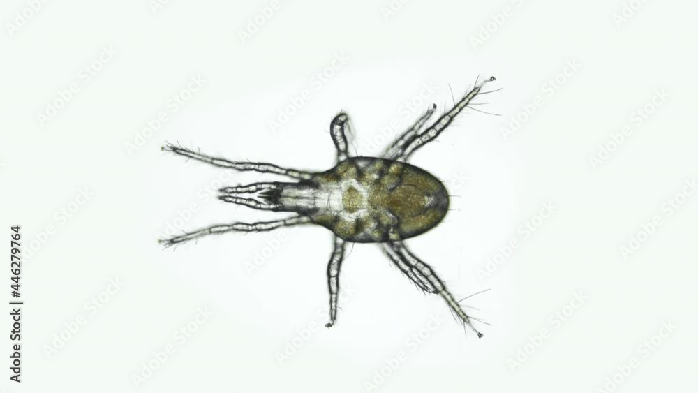 Acari mite Mesostigmata under microscope, Parasitoidea Superfamily ...