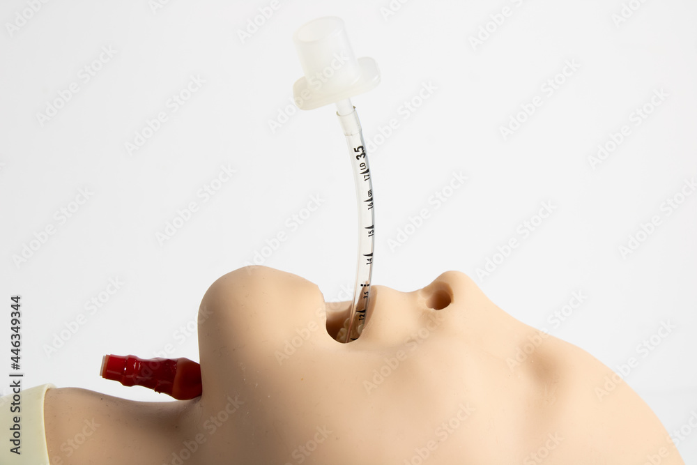 Pediatric endotracheal tube positioned. Airway management with ETT ...