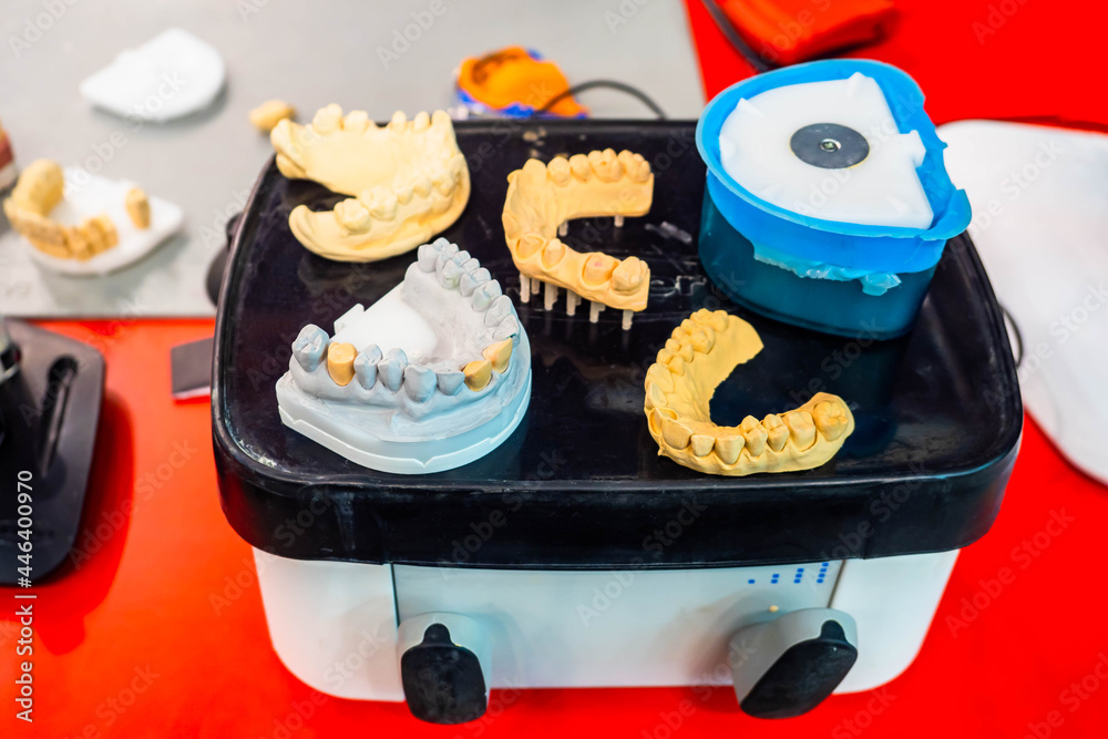 Stockfoto Dental prosthetics. Production of forms for prostheses ...