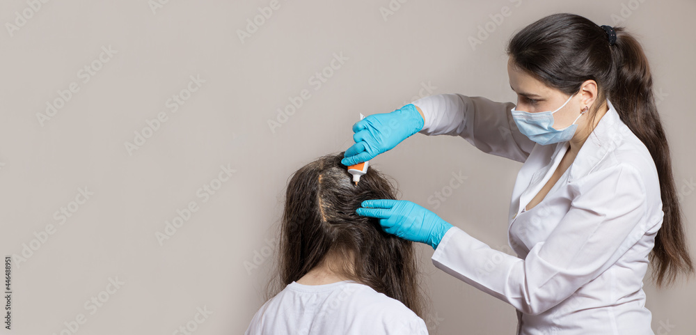 A dermatologist or trichologist applies a dandruff or lice weed to the ...