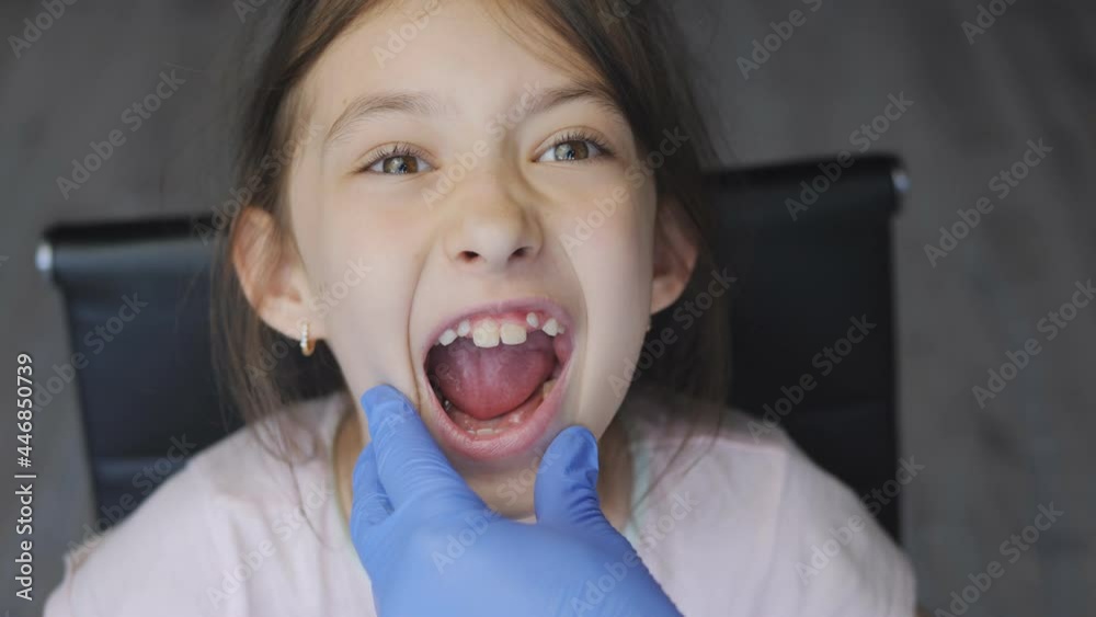 A pediatrician examines the open mouth of a child's girl, close-up ...