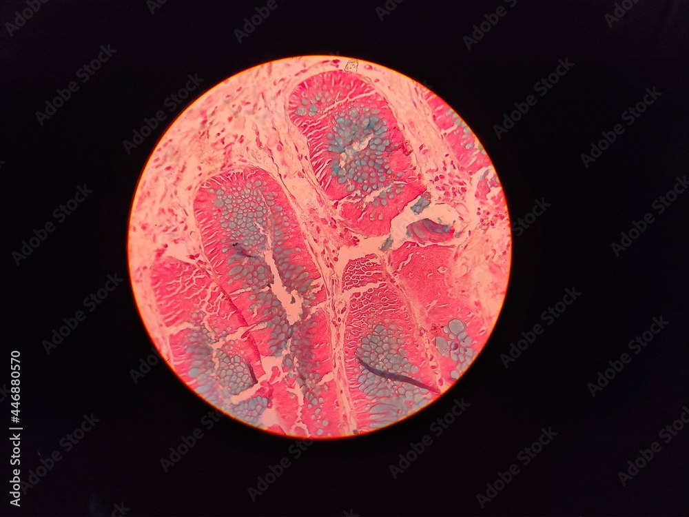 Photo & Art Print microscopic image of a human tissue stain slide ...