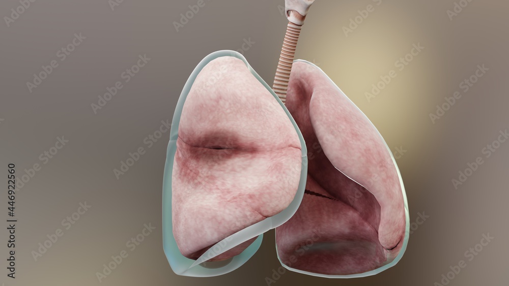 3d Illustration of Pneumothorax, Normal lung versus collapsed, symptoms ...
