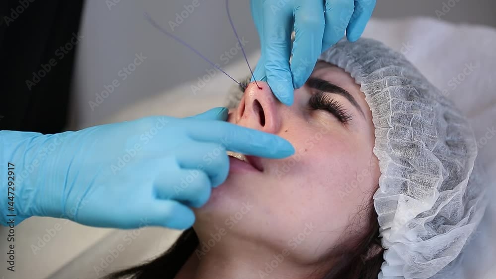 Video „Cosmetic procedure for non-surgical rhinoplasty. The beautician ...