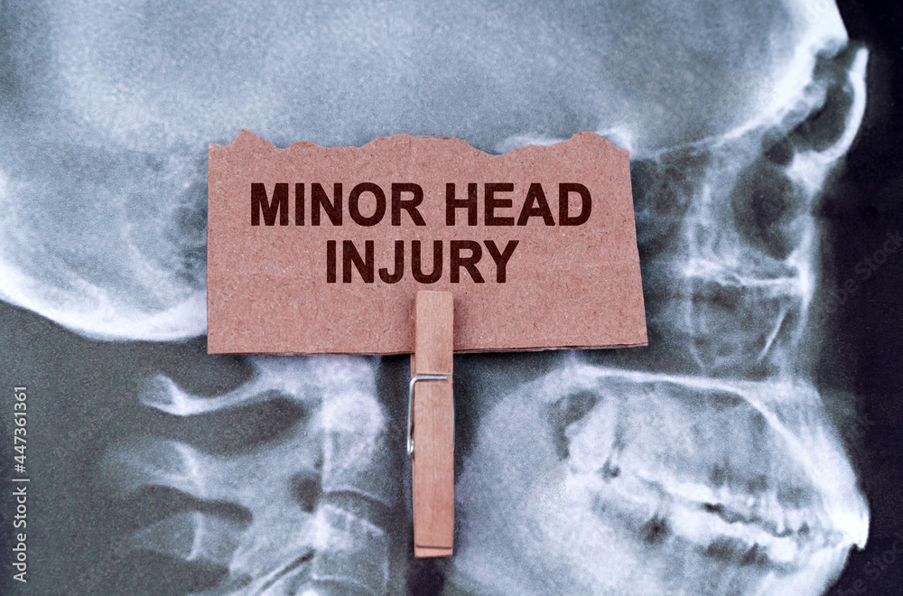 Against the background of an X-ray of the skull, a plate with the ...