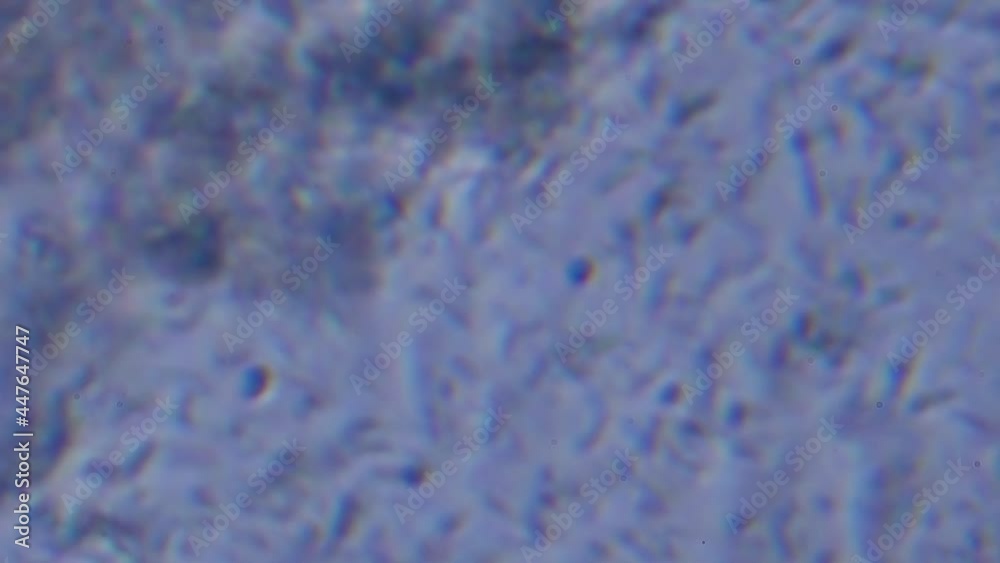 Streptococcus Staphylococcus, E. coli in human feces under a microscope ...