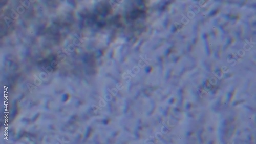 Streptococcus Staphylococcus, E. coli in human feces under a microscope ...