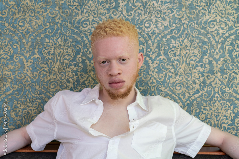 Germany, Cologne, Portrait of albino man in white shirt Stock Photo ...