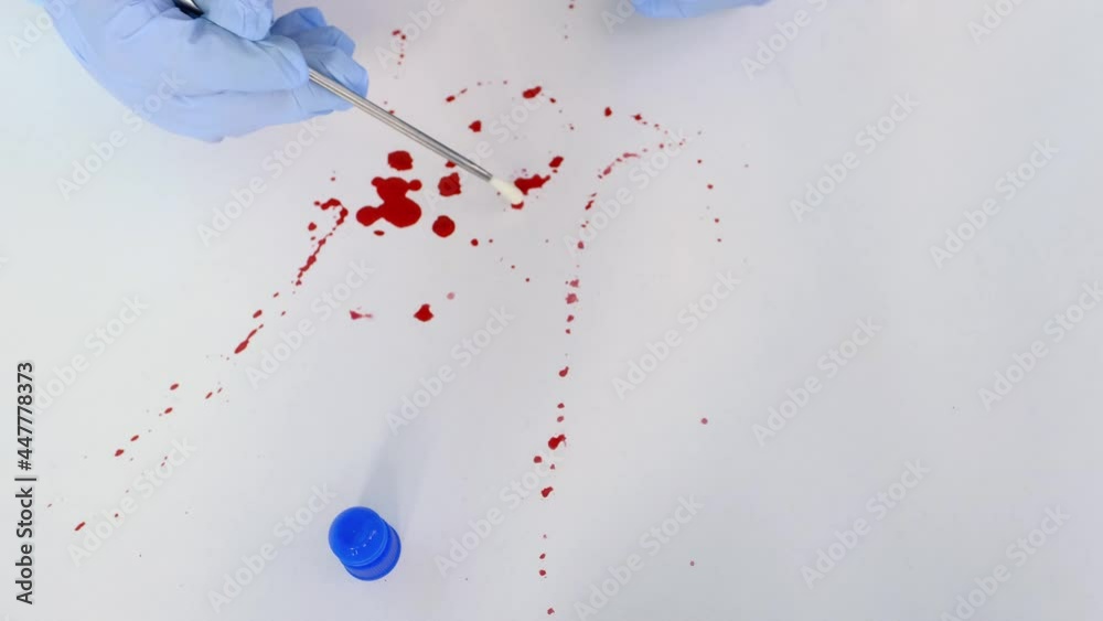 evidence idfresh splatter of red blood on white table, sharp knife ...