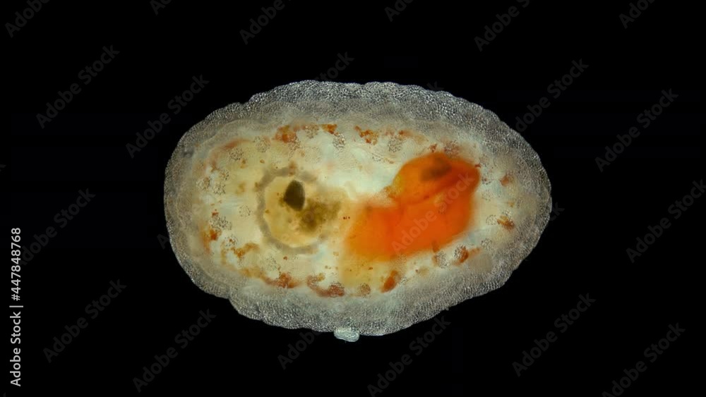 Pentacula Holothuroidea larva, Juvenile sea cucumber under microscope ...