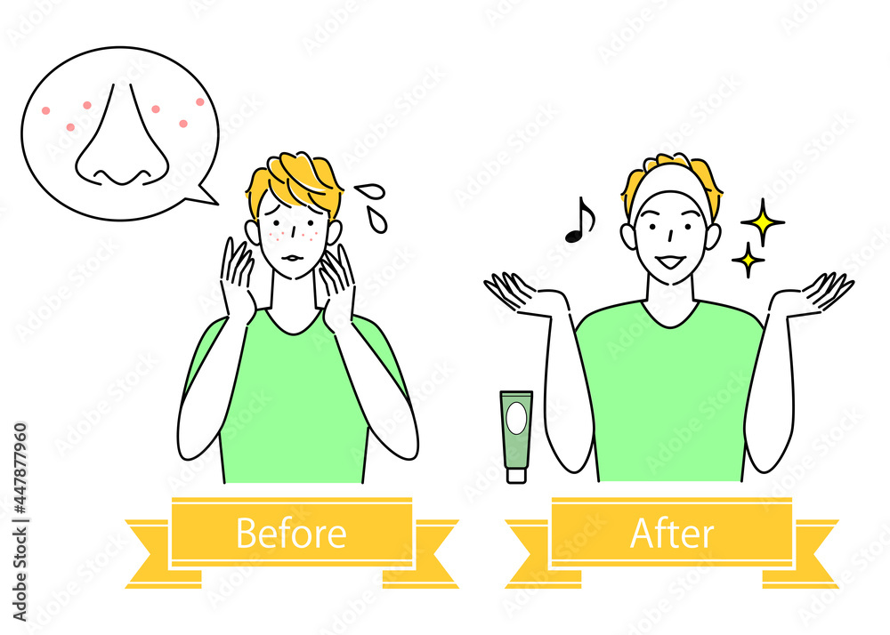 スキンケア 顔のお肌トラブルのビフォーアフター 可愛い男性のイラスト シンプル ベクター Skin Care Before and after ...