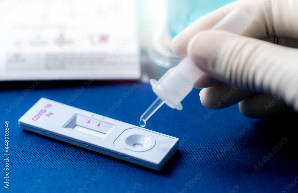 Hand holding sample tube and drops in the test device of covid 19 ...