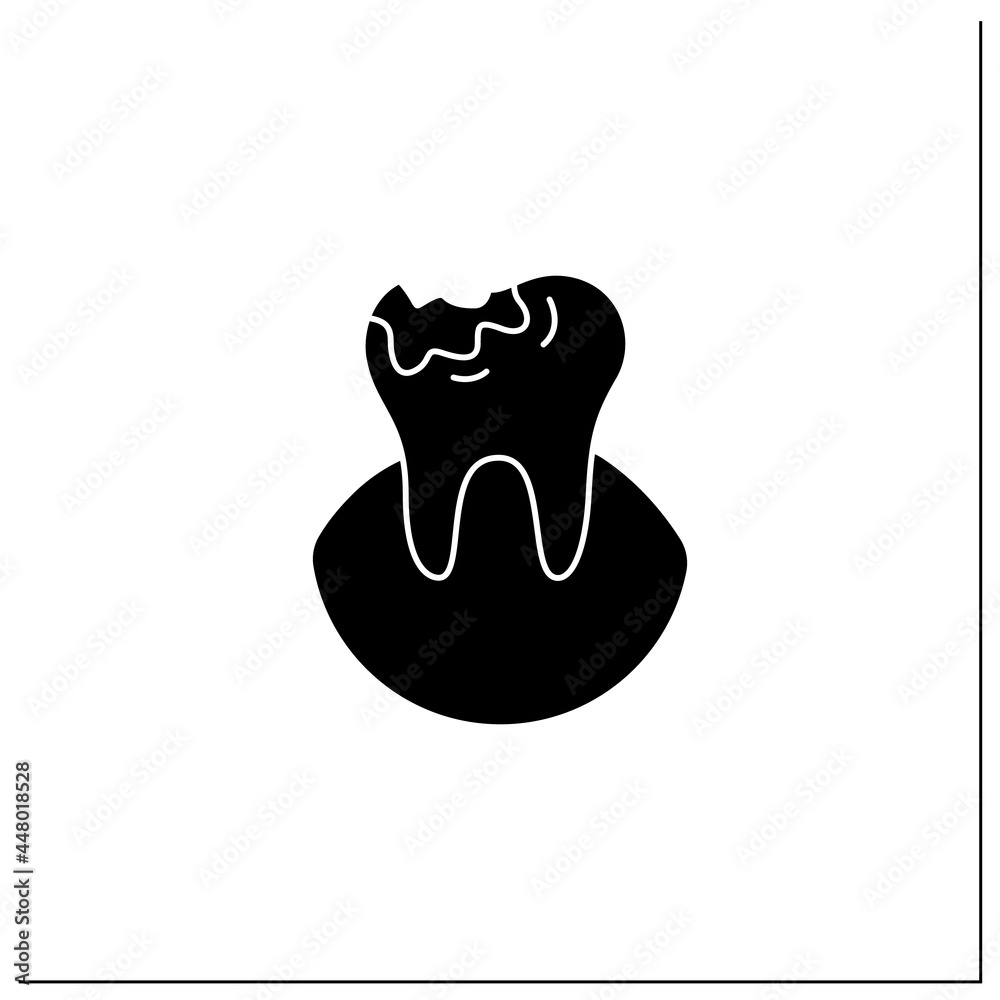 Tooth decay glyph icon. Oral surgeons treatments in dental caries ...