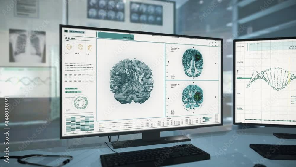 Investigating the skull for biological research using a hospital ...