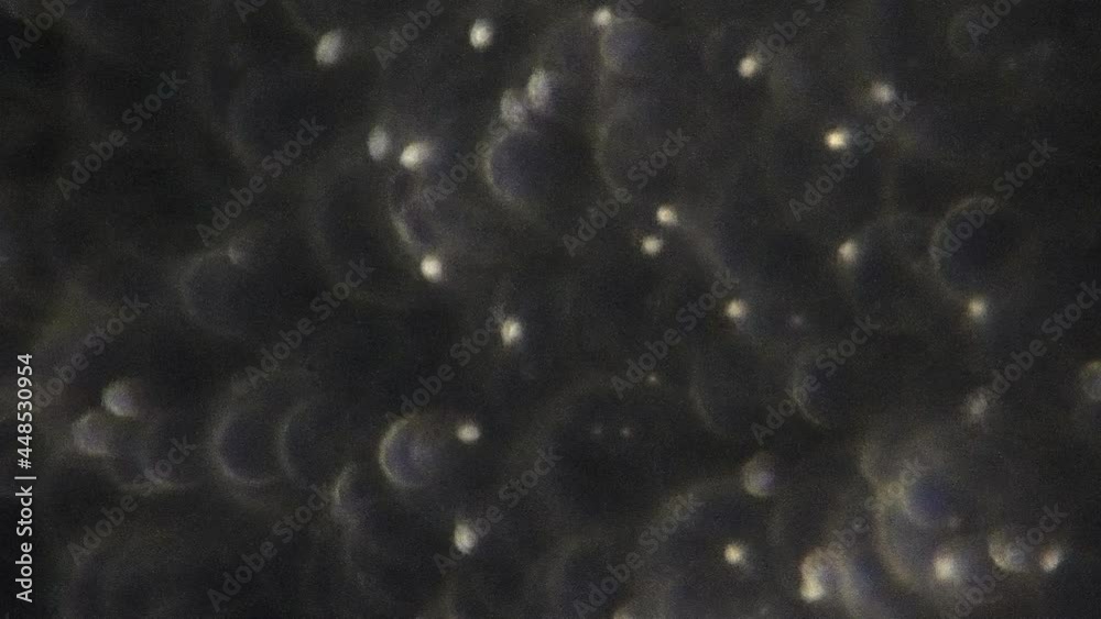 Pan across human sperm cells seen under high magnification. Stock Video ...