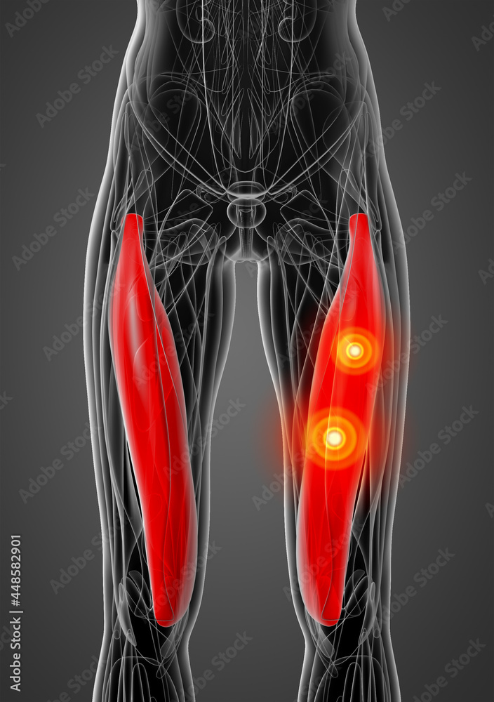 3d rendering medical illustration of the vastus medialis Stock ...