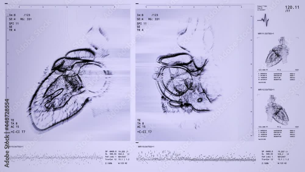 Heart scan front, side view animation. Digital artifacts, dynamic ...