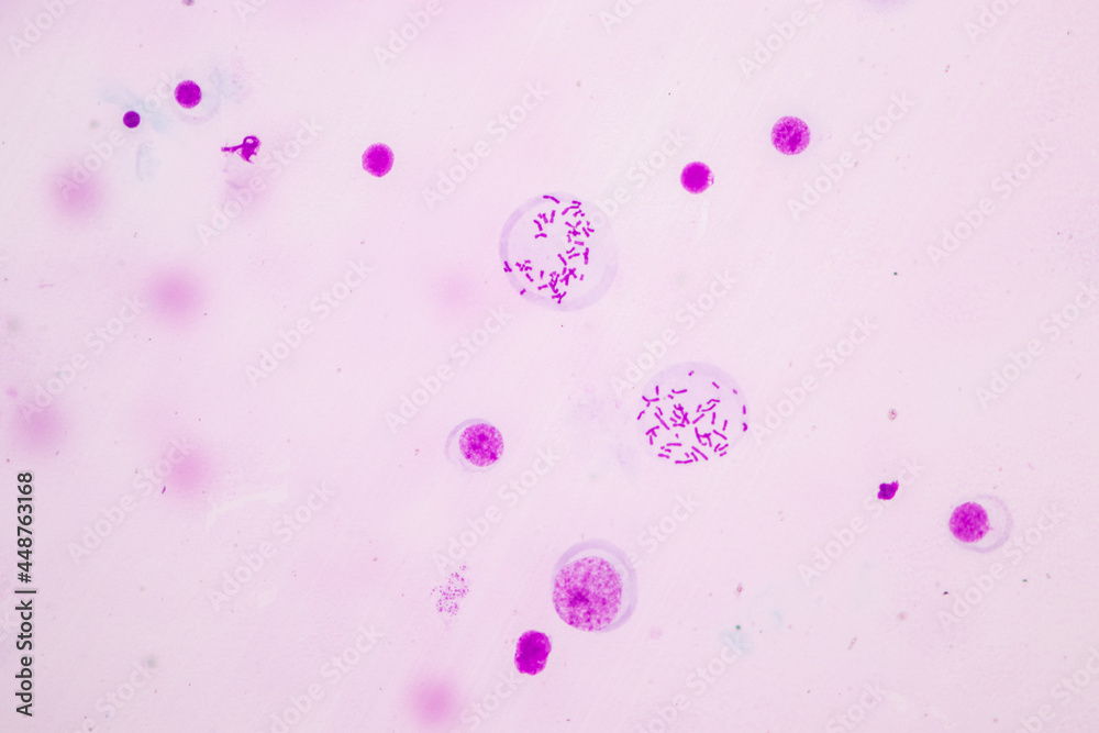 Chromosomes Human under the microscope for education. Stock Photo ...