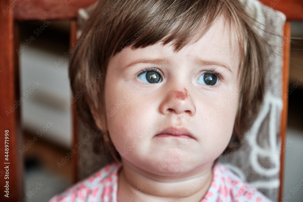 Portrait of a sad little girl with a scratched nose, close-up ...