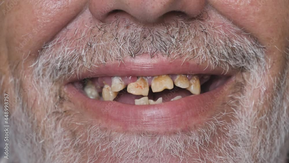 close-up shot of a toothless male mouth.A man with bad teeth. Man ...