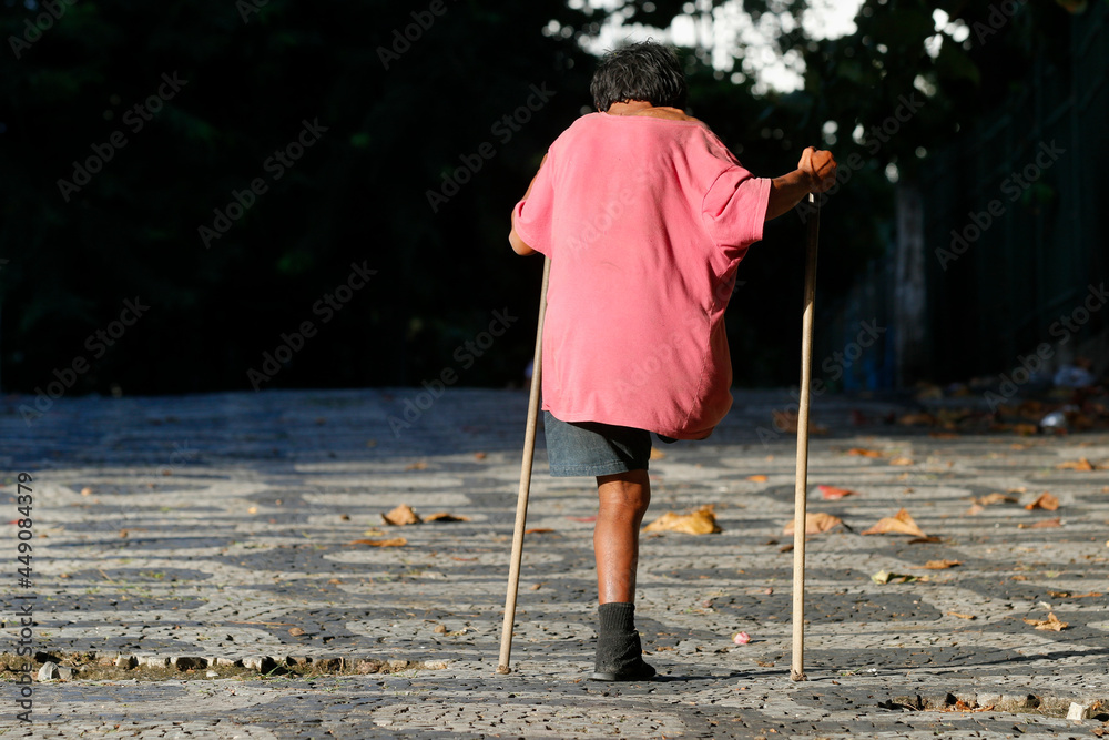 Disabled one-legged handicapped homeless man walking on crutches at ...