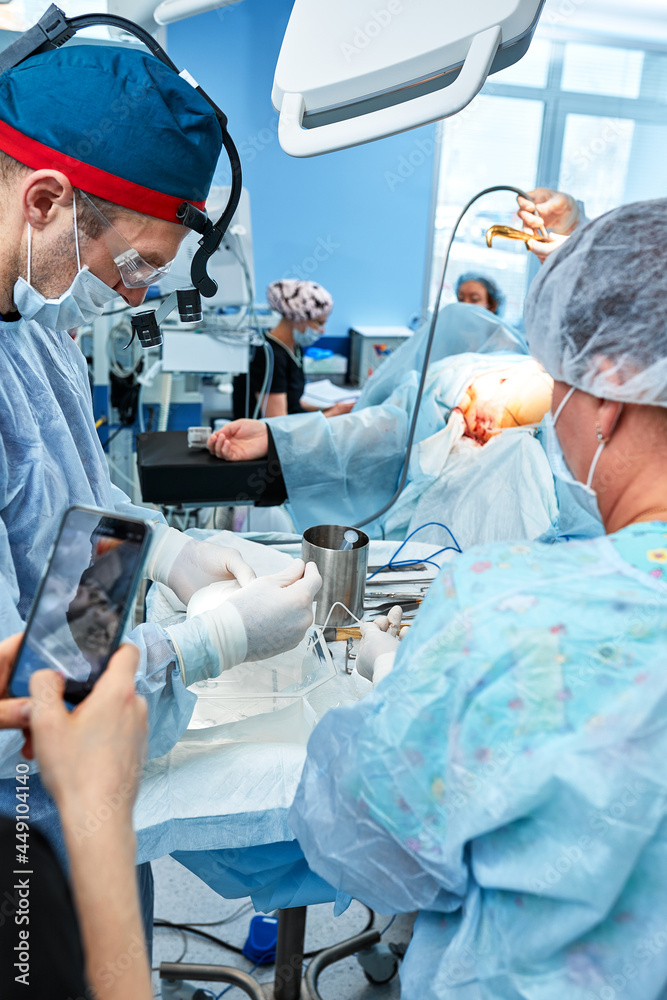 Surgeons during surgery with breast implants in their hands ...