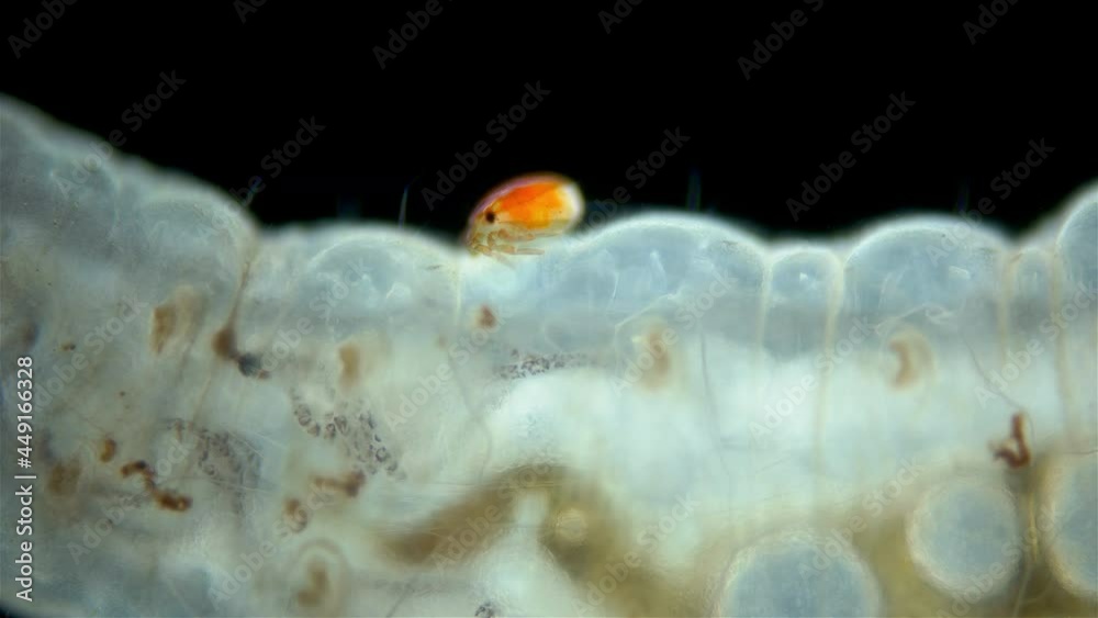 Larva mite Hydrachnidia and Hydrophilidae larva under a microscope. The ...