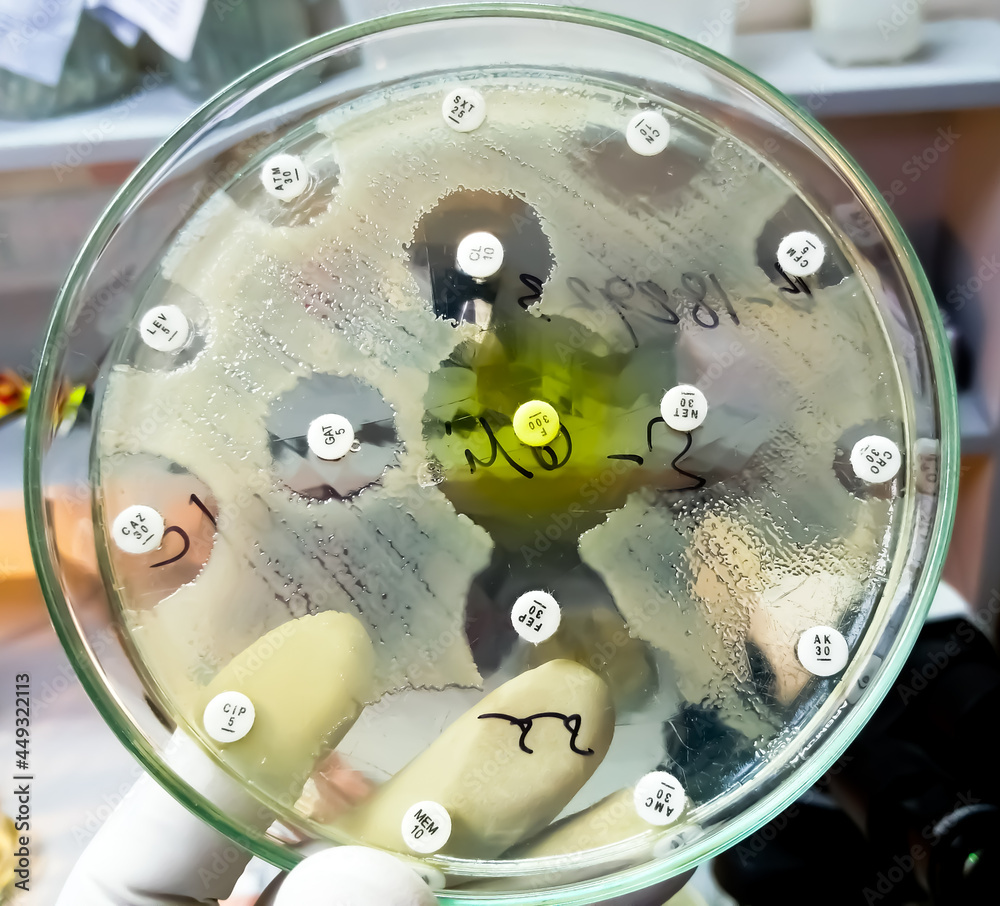 Antimicrobial susceptibility testing in petri dish. Antibiotic ...