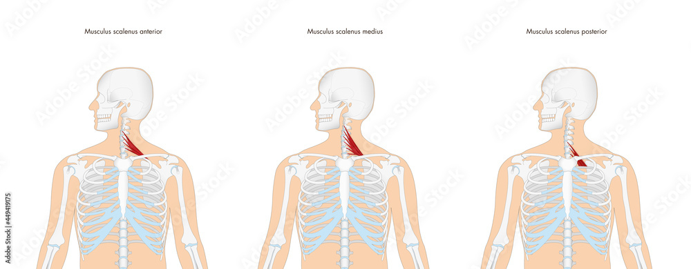 Anatomie - Halsmuskulatur - Musculi scaleni mit lateinischer ...