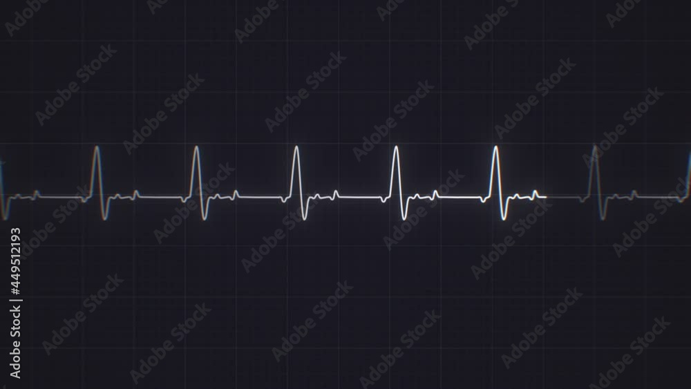 Dynamic heart rate or heart beat line. Cardiogram signal monitoring ...