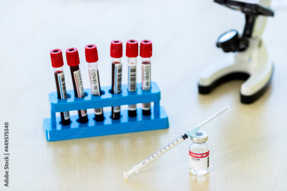 Room test tubes and lab samples of coronavirus diagnostic blood test ...