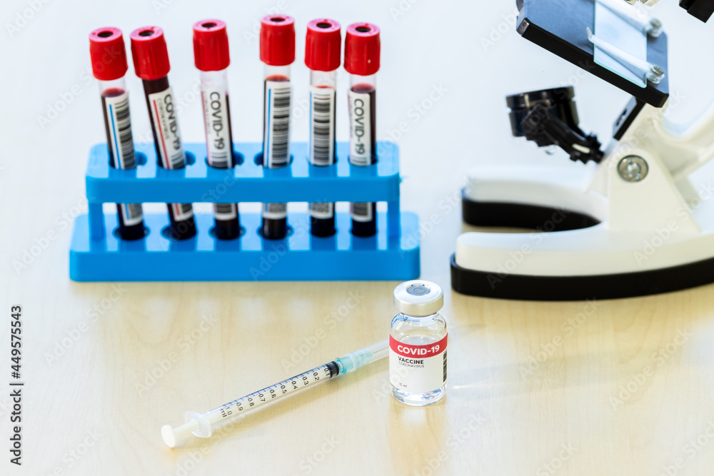 Room test tubes and lab samples of coronavirus diagnostic blood test ...