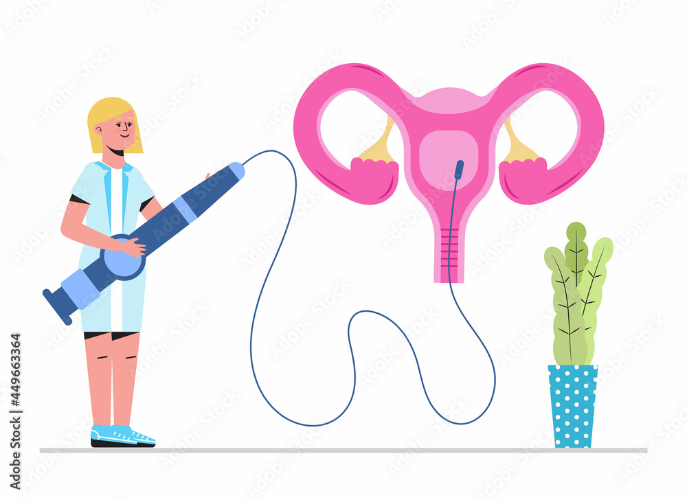 Hysteroscopy of uterus, womb concept vector. Ultrasound scan of uterine ...