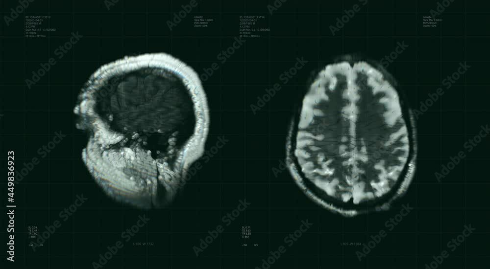 Brain scan visualization animation. Diagnosis data on laboratory ...