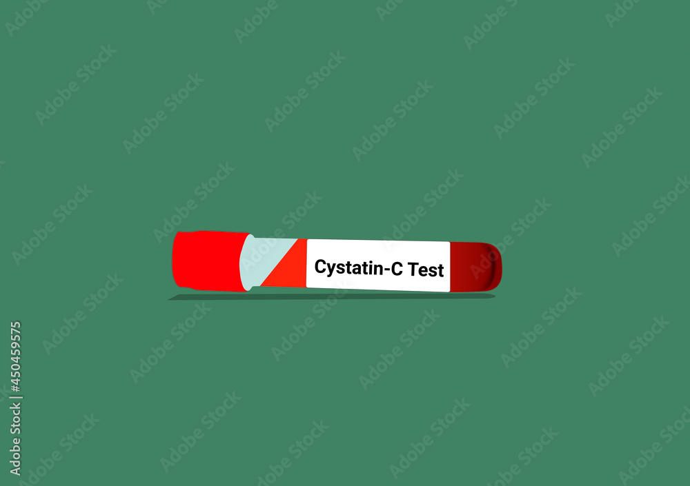 Blood samples for the Cystatin-C Test in the test tube vector with a ...