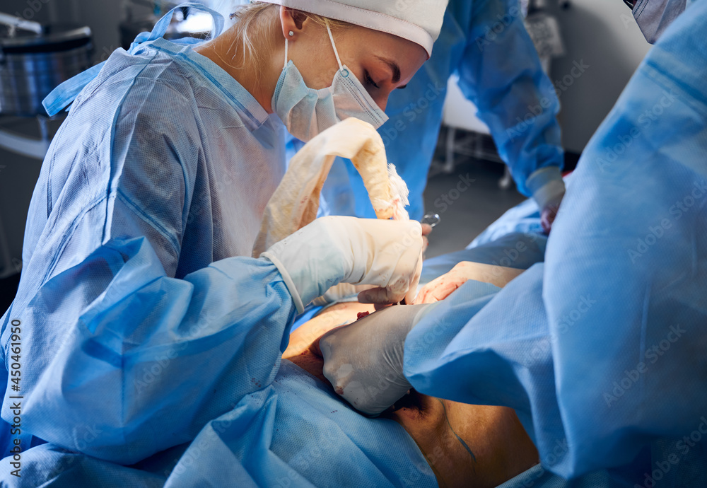 Doctors in blue uniforms performing surgical operation in operating ...