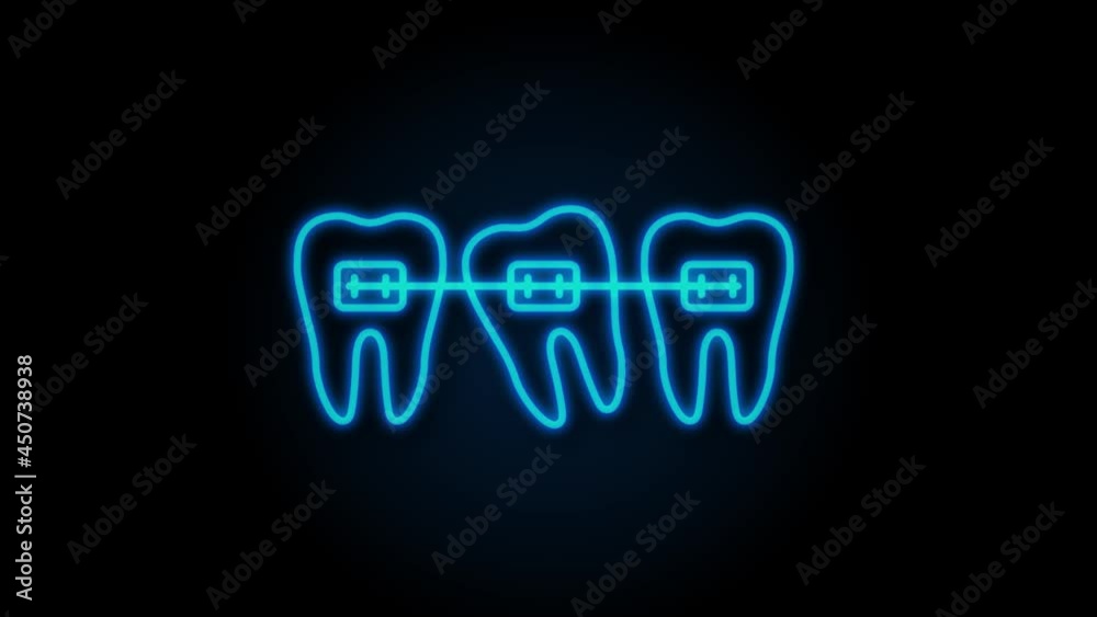 Correction of teeth with orthodontic braces. Stages of teeth alignment ...