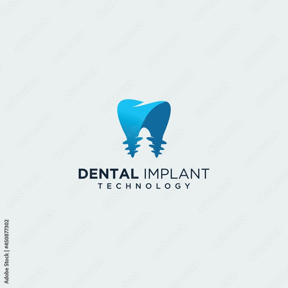 Dental implant clinic technology logo design vector dental implant logo ...