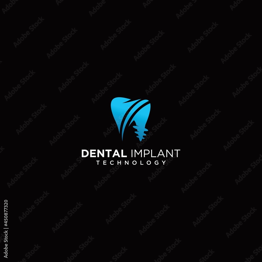 Dental implant clinic technology logo design vector dental implant logo ...
