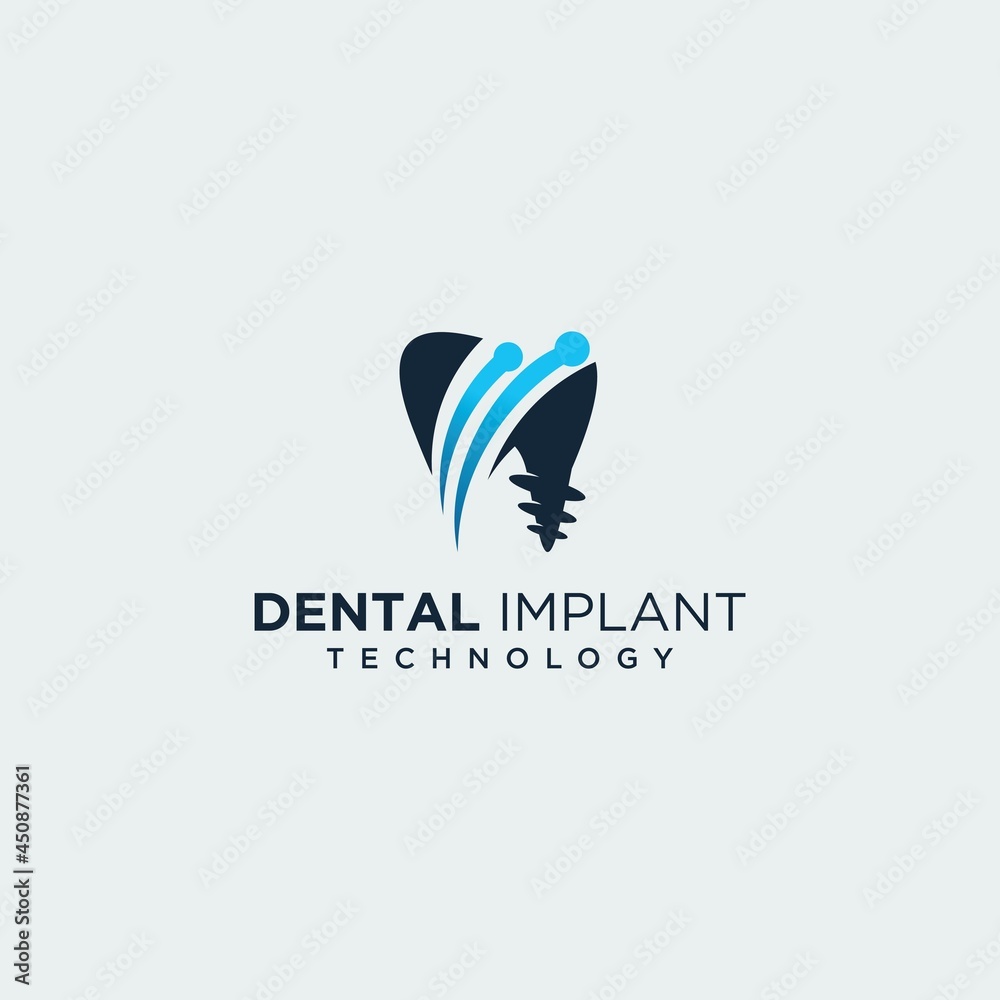 Dental implant clinic technology logo design vector dental implant logo ...